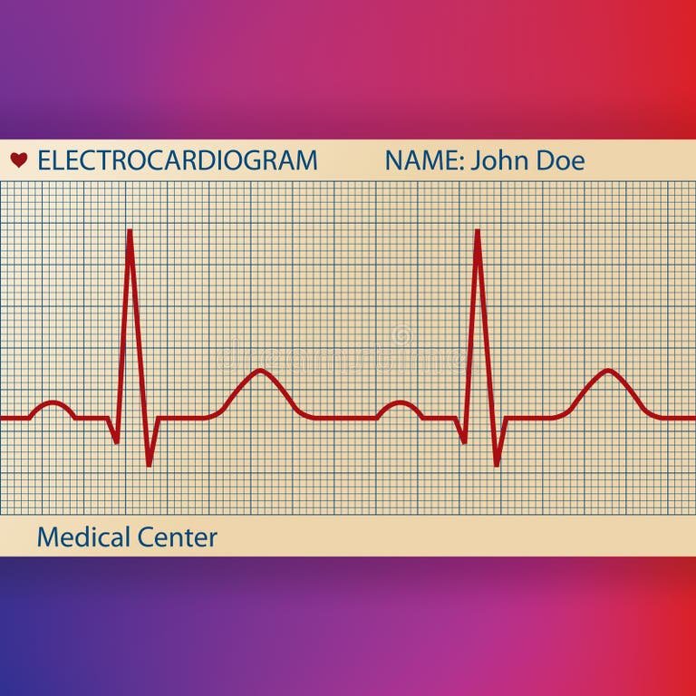 Normal Ecg Stock Illustrations – 757 Normal Ecg Stock Illustrations ...