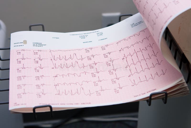Paper Read-out of Treadmill Test Stock Photo - Image of leads ...