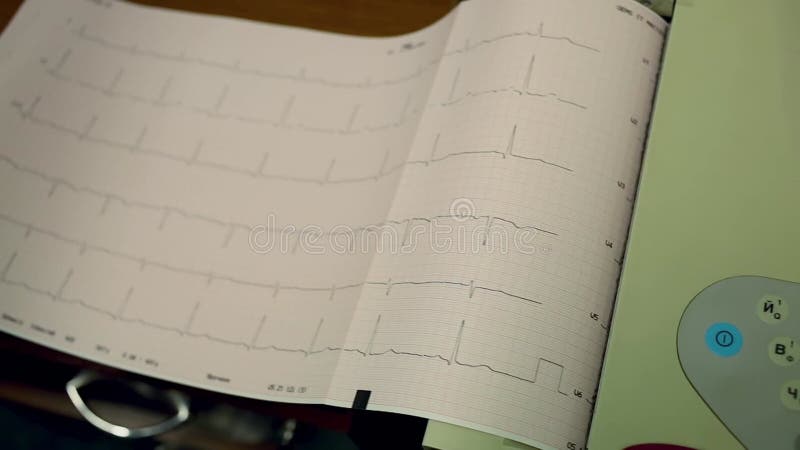 Electrocardiogram on Paper Which Goes from Printer Stock Video - Video ...