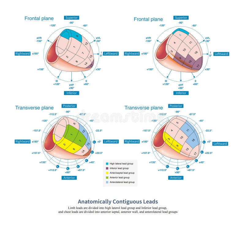 Anatomically Contiguous Leads Stock Image - Image of human, cardiac ...