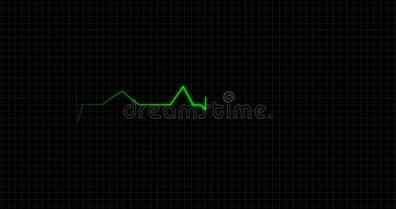 Electrocardiogram Screen, EKG Heartbeat Monitoring Stock Video - Video ...