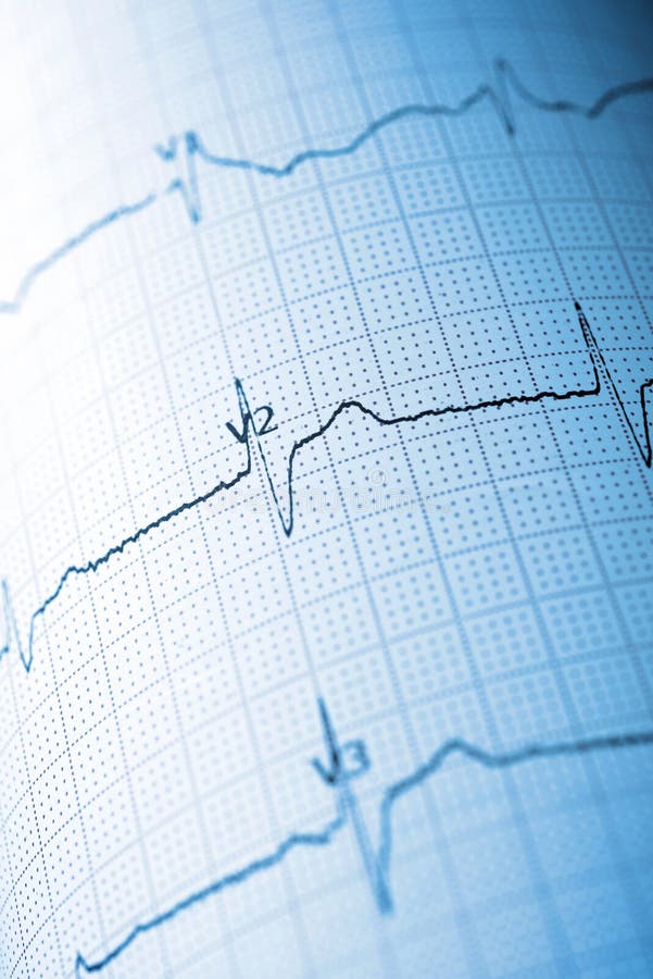 Close-up of an Electrocardiogram Printed on Blue Paper Stock Image ...