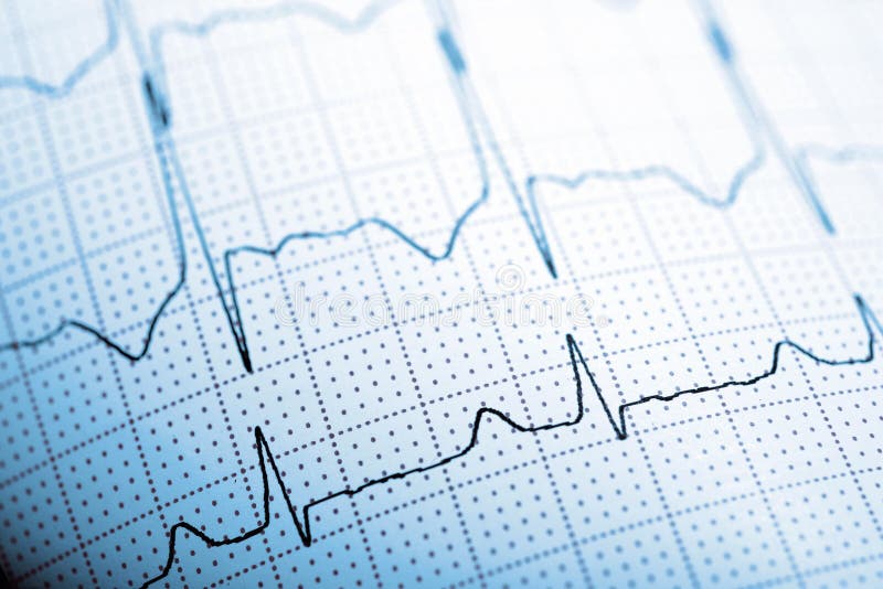 Close-up of an Electrocardiogram Printed on Blue Paper Stock Photo ...
