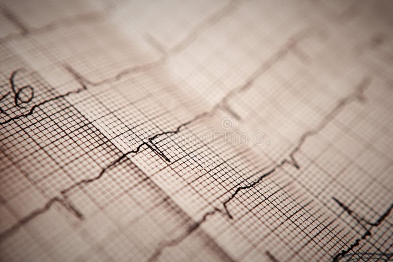 Electrocardiogram stock image. Image of close, cardiologist - 47518125
