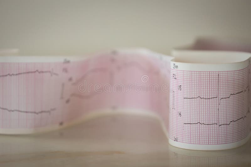 Electrocardiogram Tracing with Selective Focus on a Table. Study of the ...