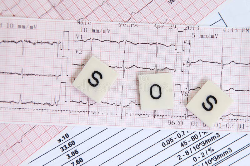 Electrocardiogram To Monitor Heart Stock Image - Image of cardiogram ...