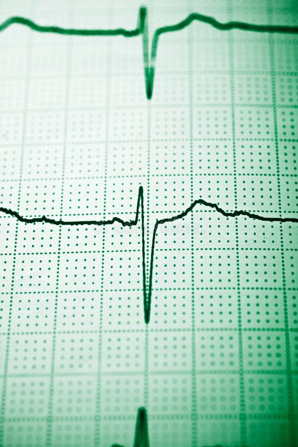 Electrocardiograph Close Up Stock Photo - Image of clinic ...