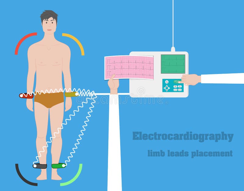 Electrocardiography Vector Concept. ECG Limb Leads Flat Illustration ...