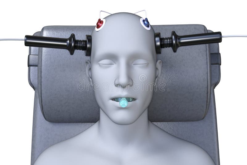 Electroconvulsive Therapy, ECT, a Treatment Involving the Use of ...