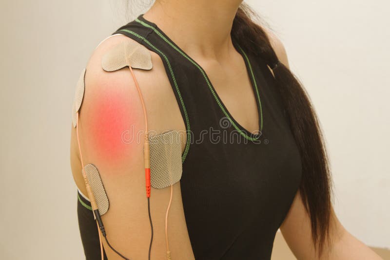 Electrodes Device on Shoulder, Transcutaneous Interferential El Stock ...