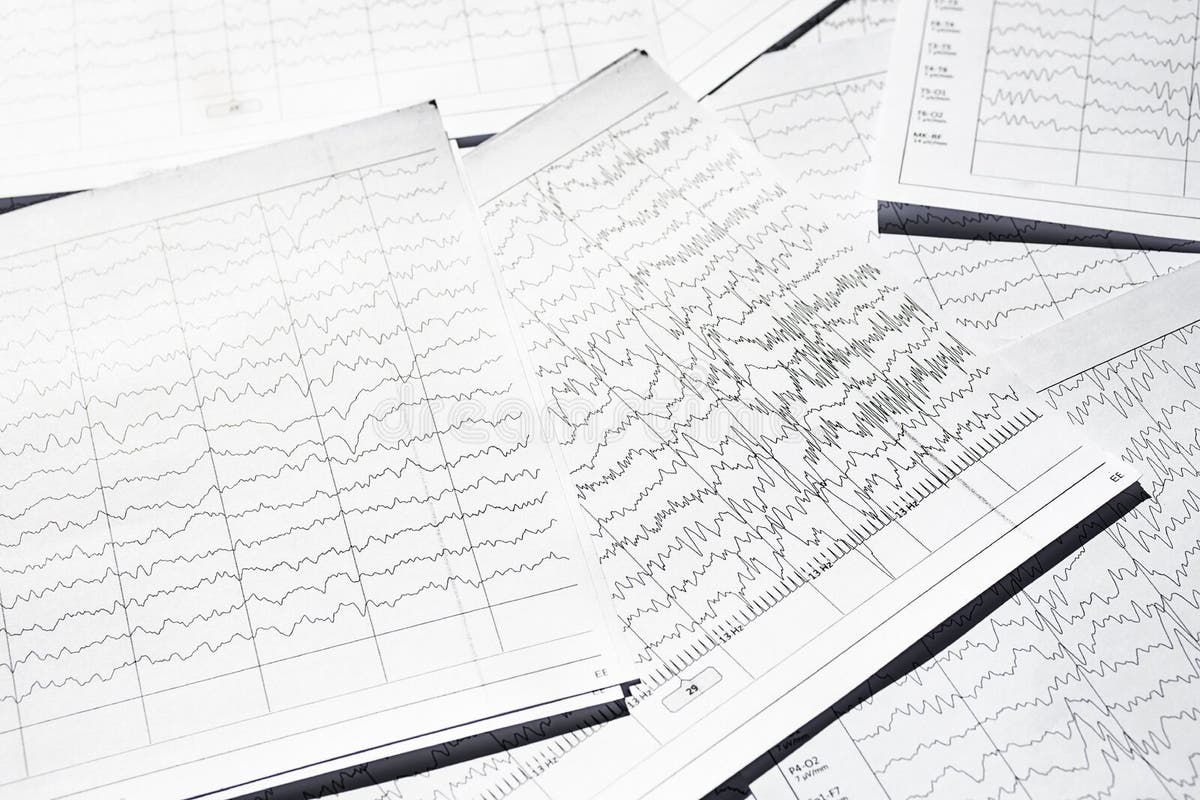 Eeg Reading Stock Photos - Free & Royalty-Free Stock Photos from Dreamstime