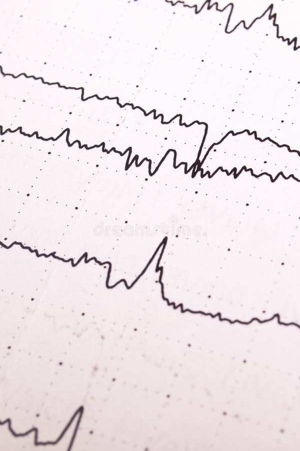 Electroencephalogram Graph on White Paper Close Up Stock Photo - Image ...