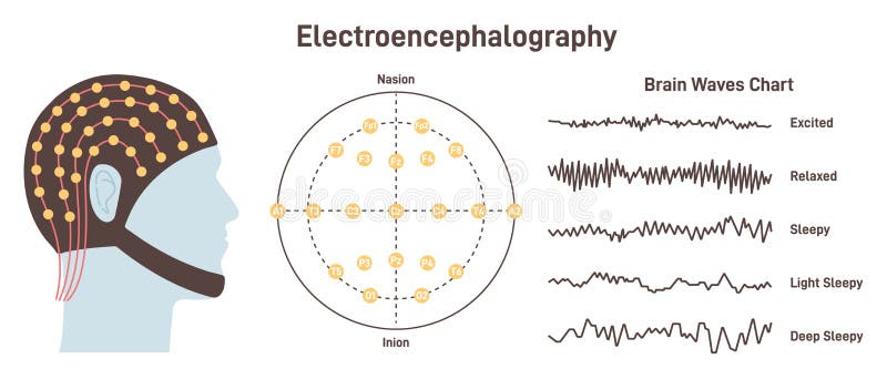 Electroencephalography. Medical Test that Measures Electrical Activity ...