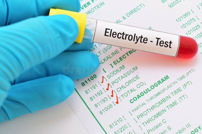 Electrolyte test stock photo. Image of experiment, anion - 103015296