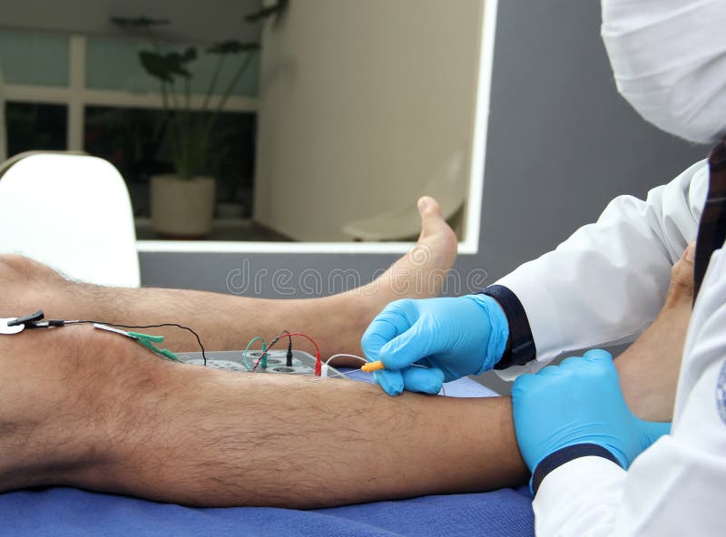 Electromyography Graphic Recording of the Electrical Activity Produced ...