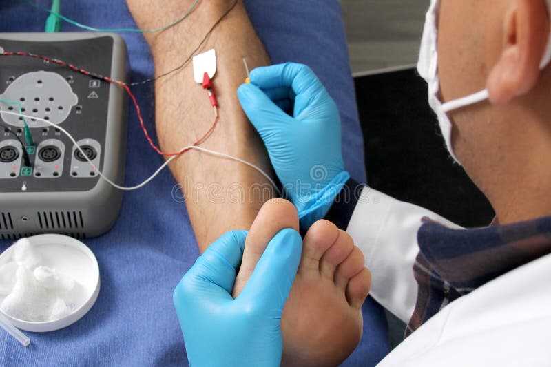 Electromyography Graphic Recording of the Electrical Activity Produced ...