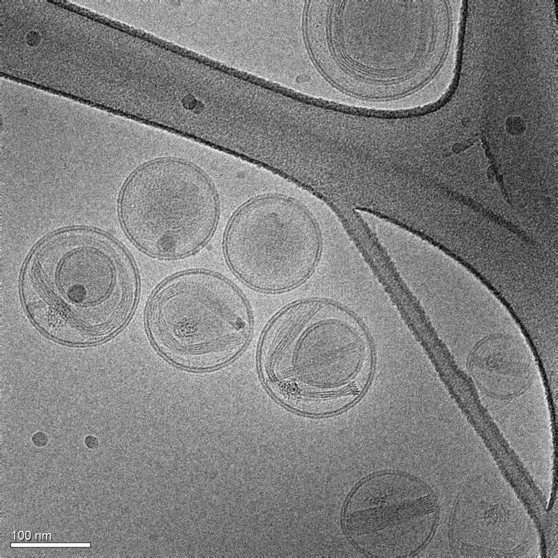 Electron Image of Nanoparticles Made of Lipids Containing an Anticancer ...