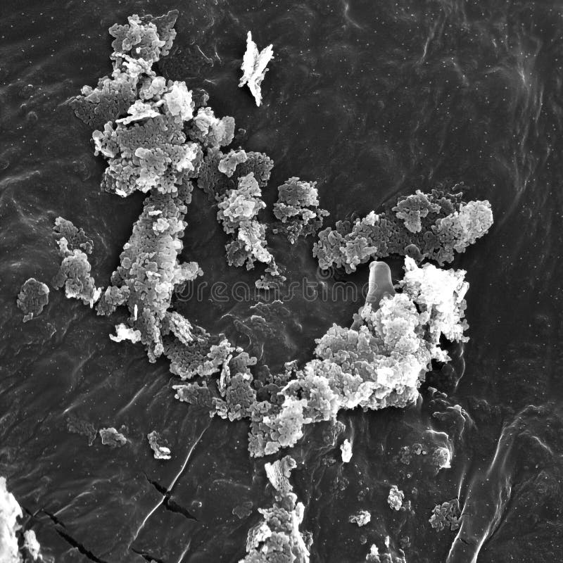 Electron Imagen Microscopy - Bacteria on Bugger_mucus Stock Photo ...