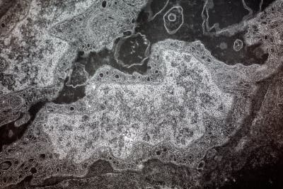 Electron Micrograph of a Cell Nucleus Stock Photo - Image of macro ...