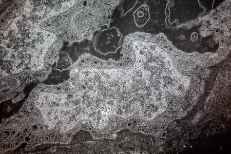 Electron Micrograph of a Cell Nucleus Stock Photo - Image of macro ...
