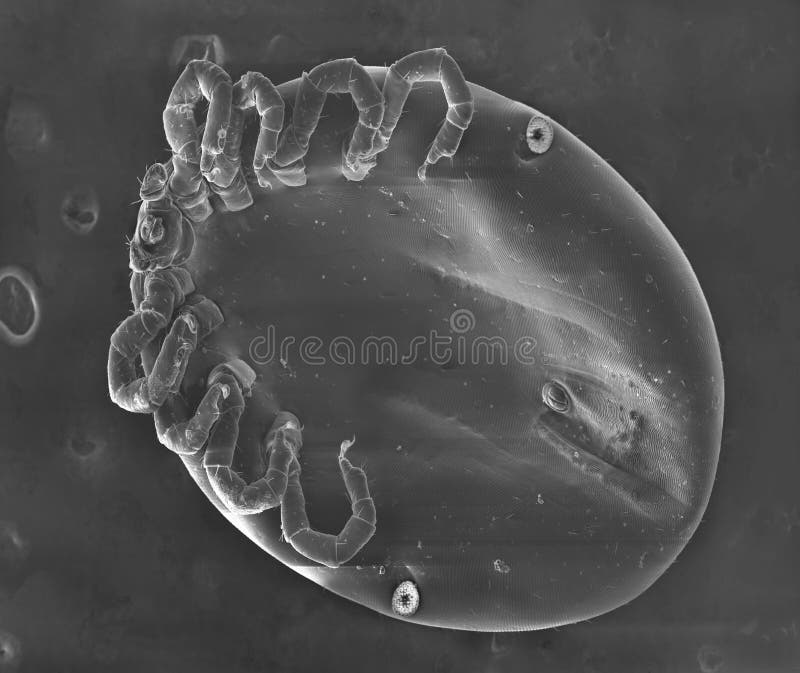 Electron microscope-mite stock image. Image of microscope - 32658399