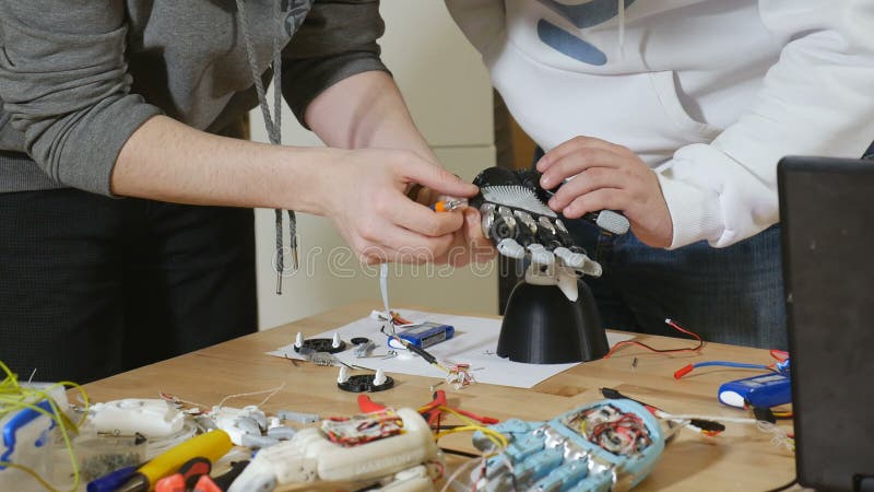 Bionic Prosthetic Arm for People with Amputated Limb. Generative AI ...