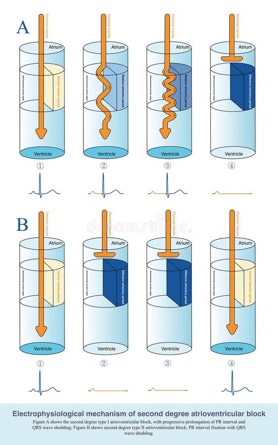 Normal Left Ventricle Cardiac Cycle Stock Photos - Free & Royalty-Free ...