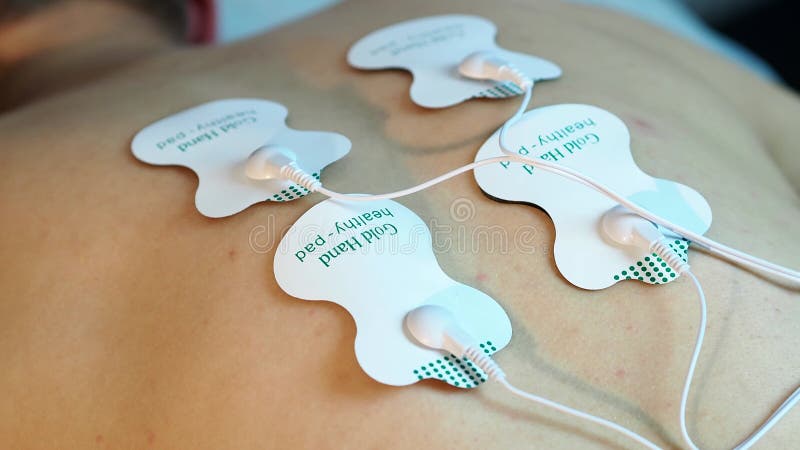 Electrotherapy. Physiotherapy Procedure, Myostimulation of the Back ...