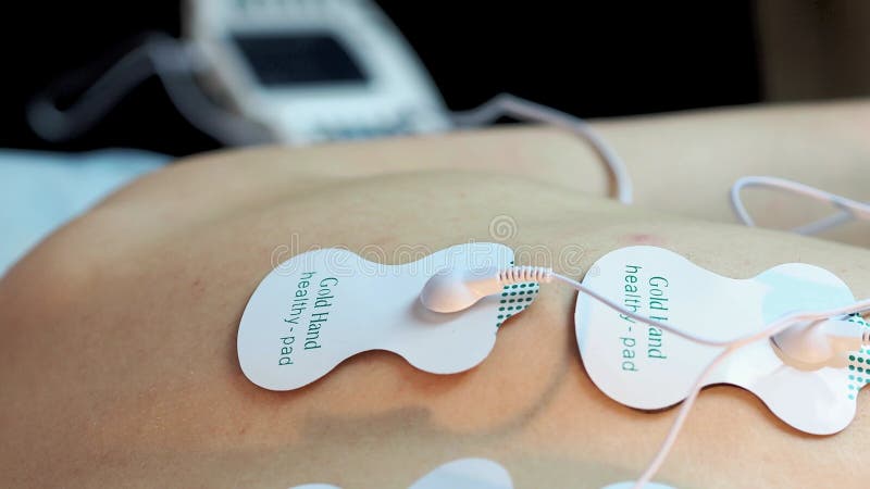 Electrotherapy. Physiotherapy Procedure, Myostimulation of the Back ...