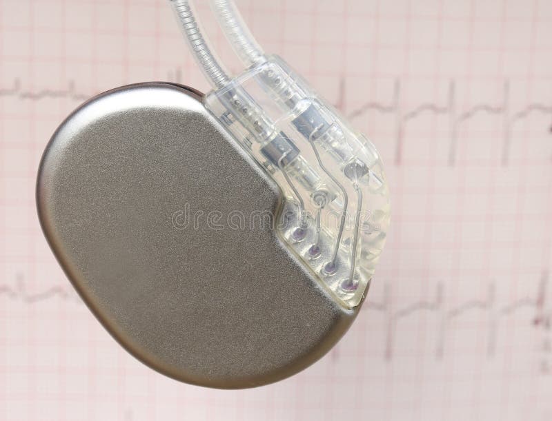 Elektrocardiograaf Met Hartstimulator Stock Foto - Image of ...