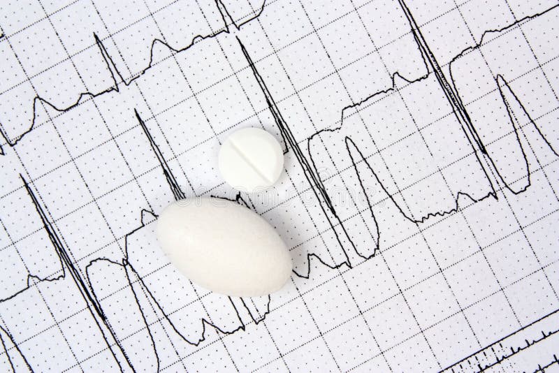 Elektrokardiogram ECG arkivfoto. Bild av kardiograf, elektrokardiografi ...