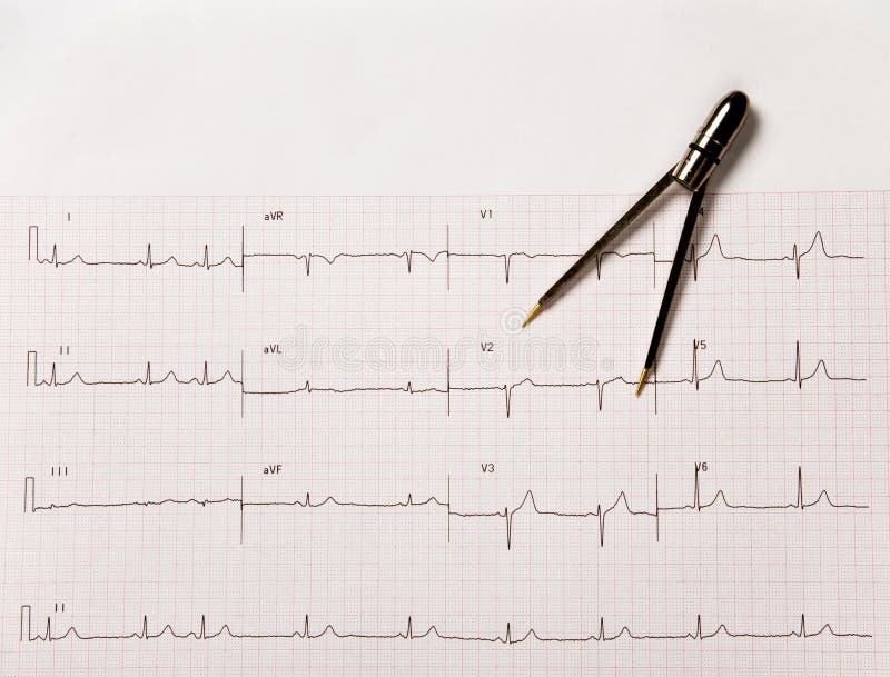 Elettrocardiogramma, O EKG, Con I Compassi Immagine Stock - Immagine di ...