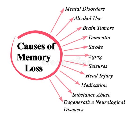 Causes of Memory Loss stock illustration. Illustration of seizures ...