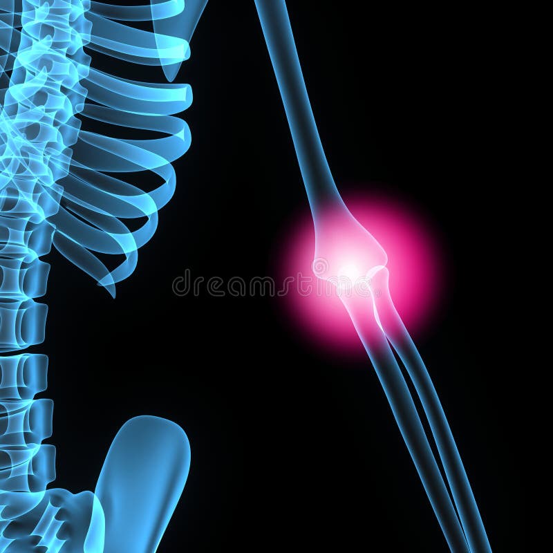 Ellbogengelenk stock abbildung. Illustration von menschlich - 45342332