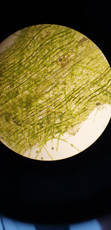 Elodea Canadiensis Bajo El Microscopio Foto de archivo - Imagen de hoja ...