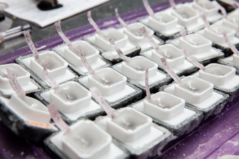 Embedded Tissues in Paraffin Blocks for Sectioning. Pathology ...