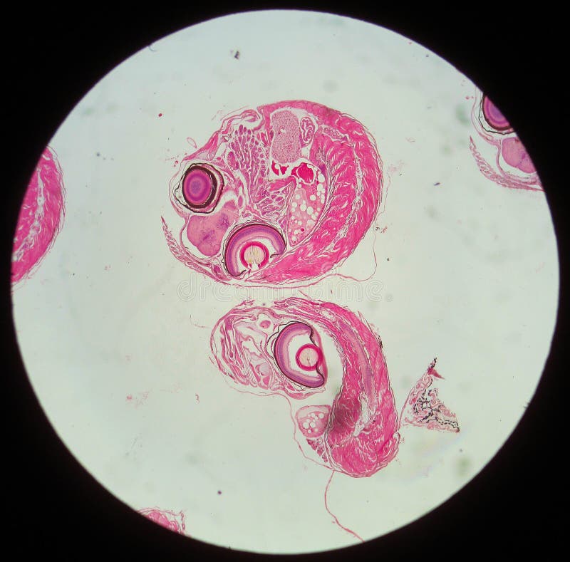 The embryo stock photo. Image of technique, organism - 27500876