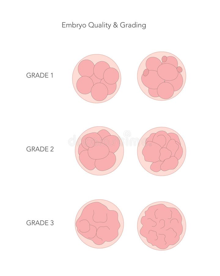 Embryos Quality and Grades. in Vitro Obtained Human Embryo Early ...