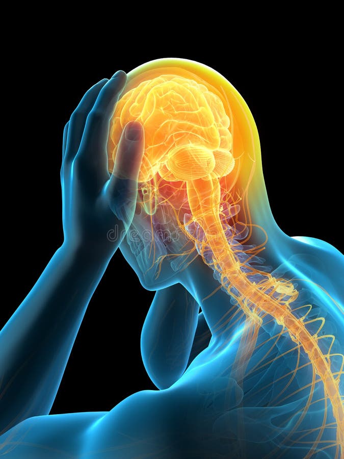 Mal di testa/emicrania illustrazione di stock. Illustrazione di ...
