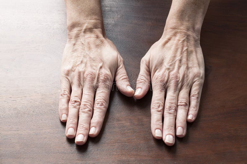 Empty Female Hands Turned on Their Back Side Stock Photo - Image of ...
