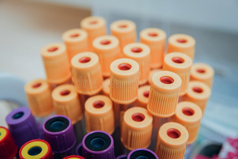 Empty Tubes. Background . Medical Equipment. Blood Test. Stock Image ...