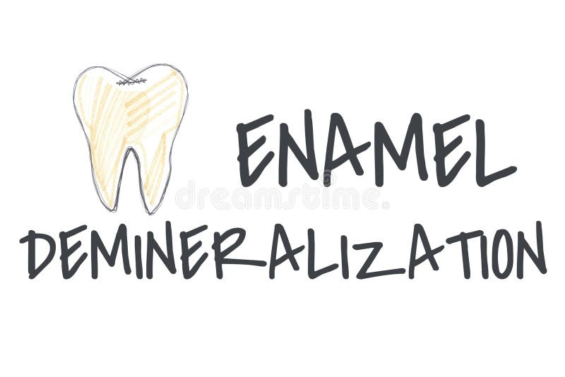 Enamel Demineralization Text Words Phrase on Tooth Illustration ...