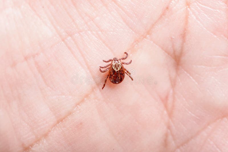 Encephalitis Tick in the Hands of Man Stock Image - Image of bacteria ...