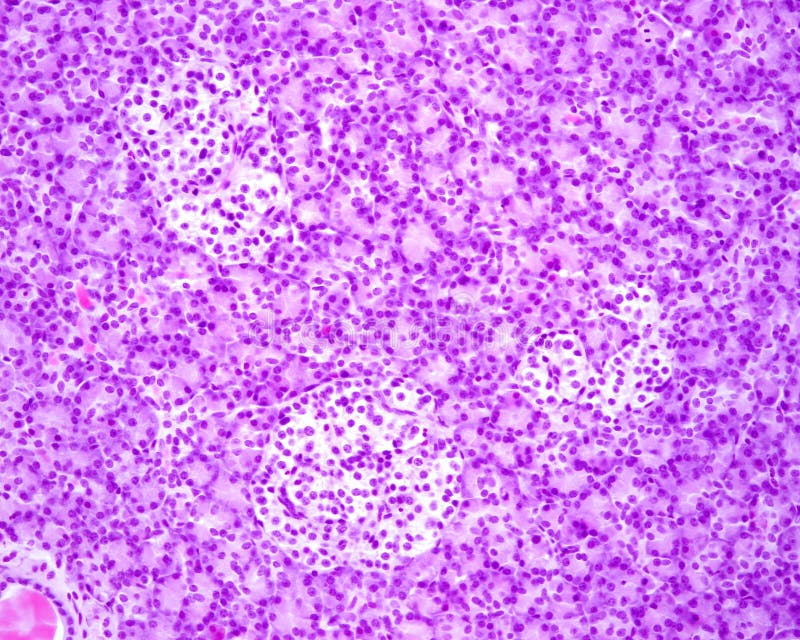 Endocrine Pancreas. Islets of Langerhans Stock Photo - Image of ...