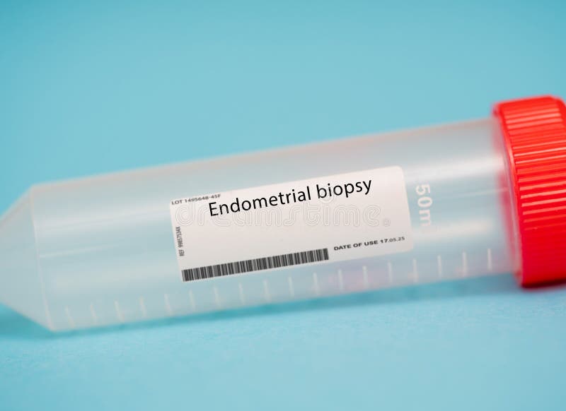 Endometrial biopsy stock photo. Image of tube, endometrial - 276190550