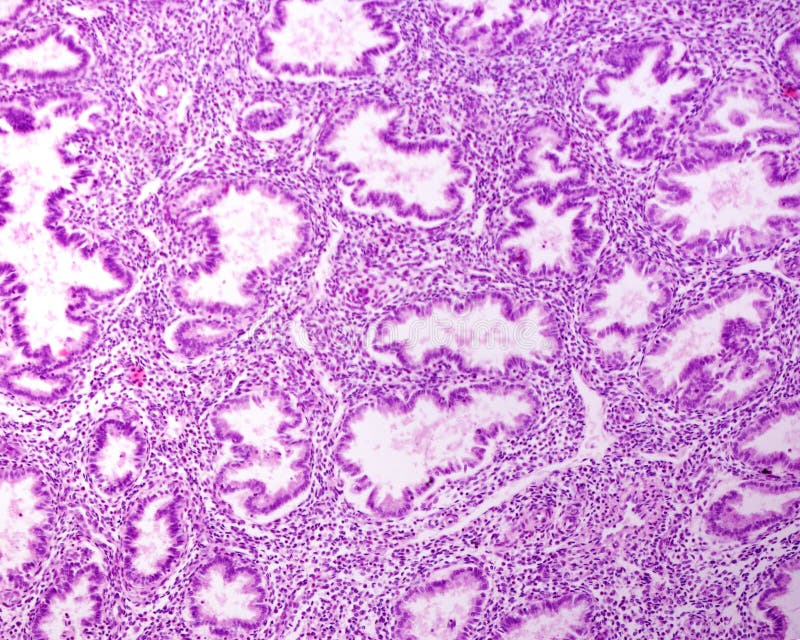 Endometrium. Secretory Phase Stock Photo - Image of normal, histology ...