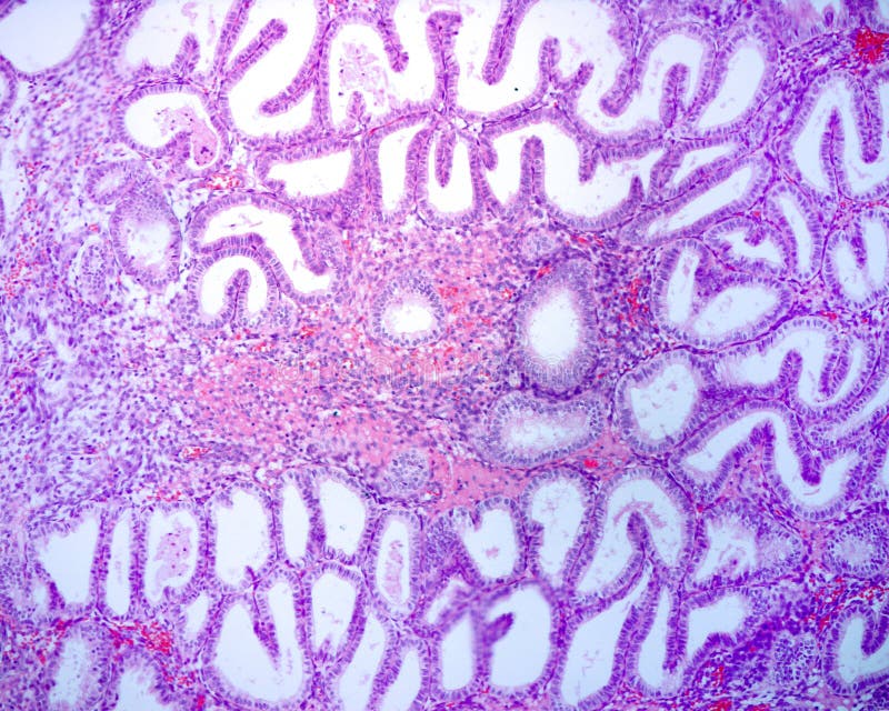 Endometrium. Secretory Phase Stock Image - Image of histology ...