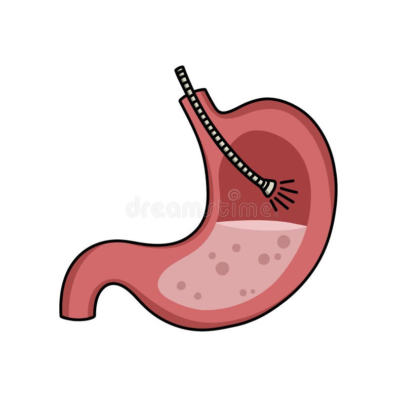 Endoscopy Doodle Icon, Vector Color Line Illustration Stock Vector ...