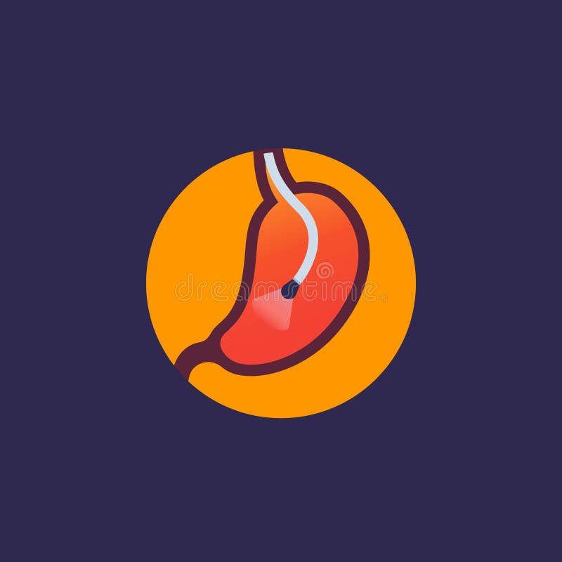 Endoscopy Stock Illustrations – 1,582 Endoscopy Stock Illustrations ...