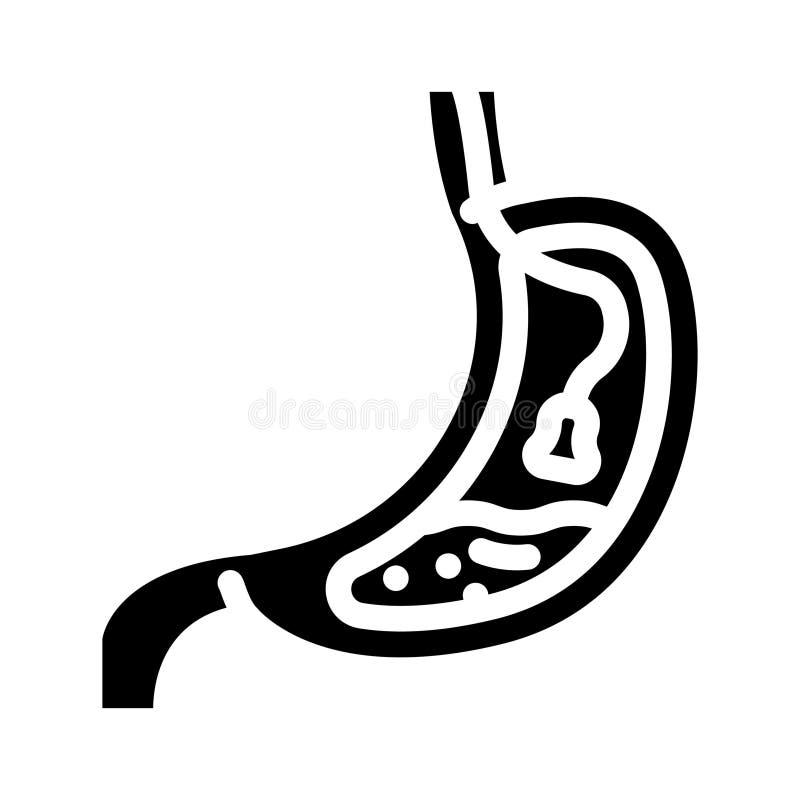 Endoscopy Surgery Glyph Icon Vector Illustration Stock Illustration ...